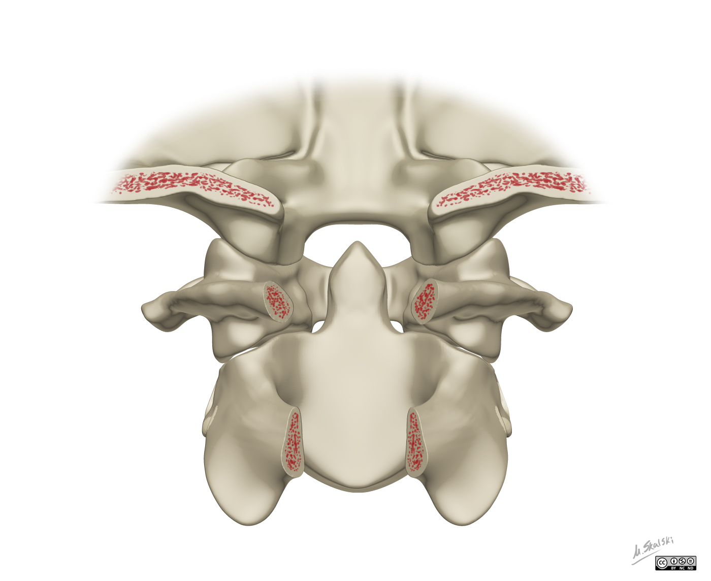 Radiopaedia Drawing Atlas And Axis From Posterior No Labels Anatomytool